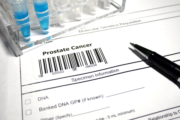 Invitae touts results of trial for prostate cancer genetic testing ...