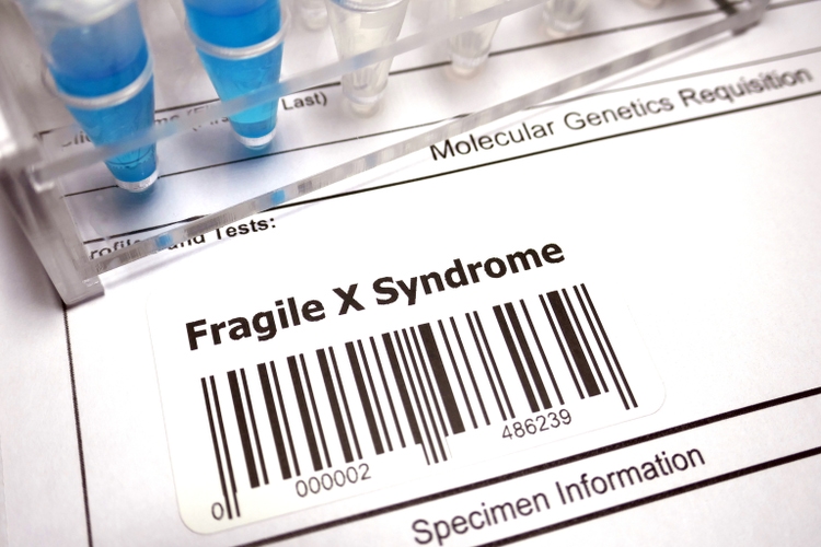 Zynerba Pharma rises 6% on positive data from Fragile X syndrome ...