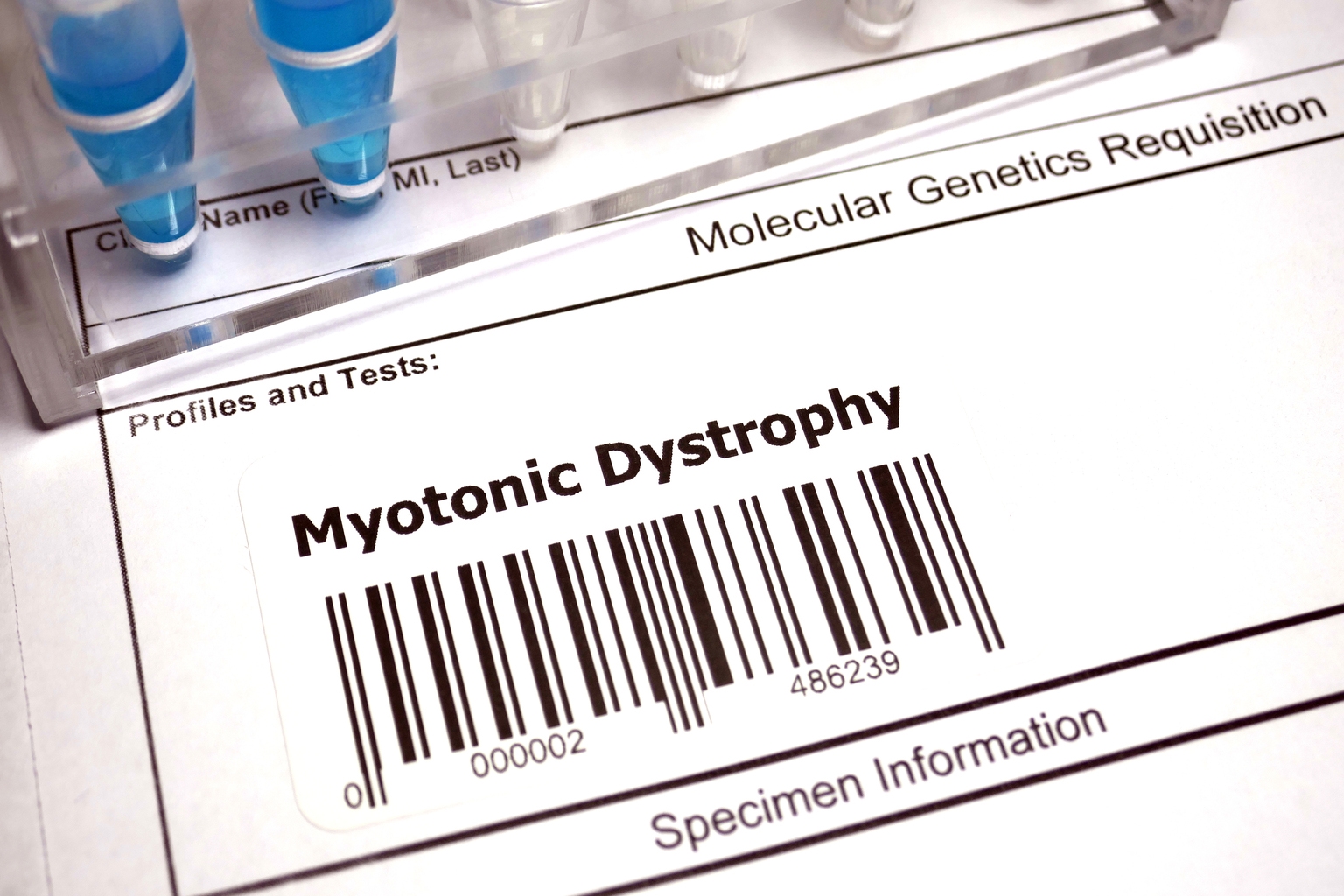 Avidity Biosciences: Anticipated Persistent Stock Fluctuations Call For ...