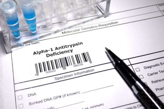 Wave Life Sciences receives back rights to AATD therapy from GSK ...