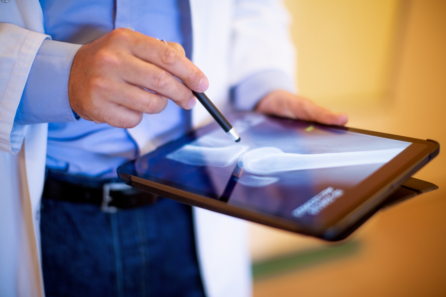 Mereo BioPharma (MREO): Risky Proposition Despite Strides In Rare ...