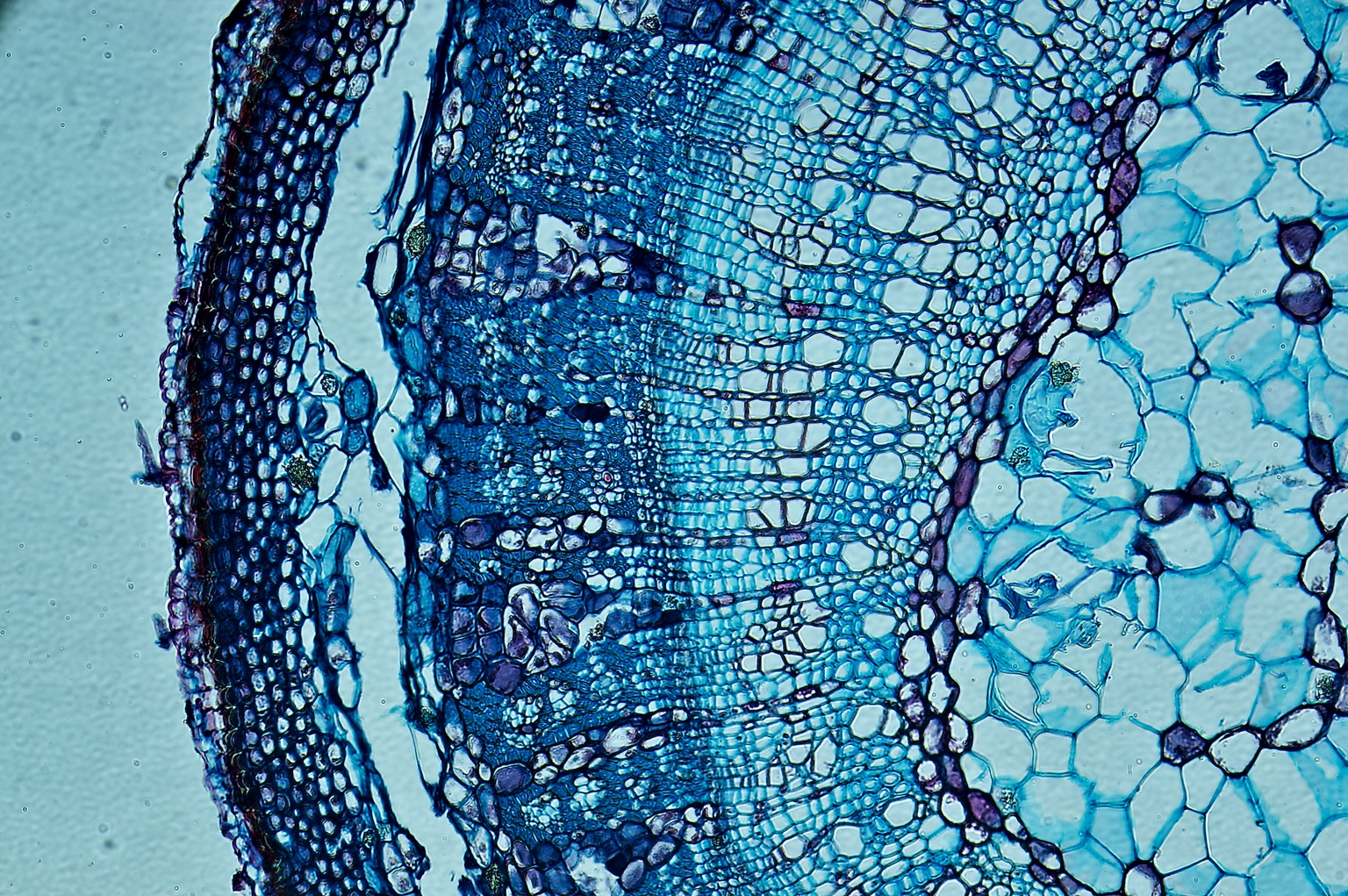 Humacyte Gets A Lifeline (NASDAQ:HUMA) | Seeking Alpha