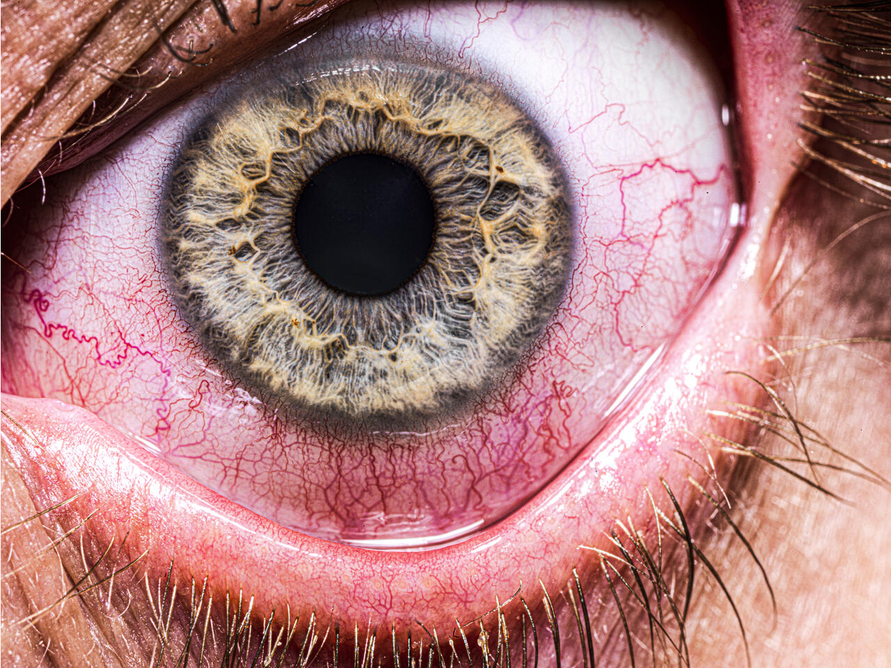 Horizon Therapeutics touts long-term efficacy data on Tepezza for ...