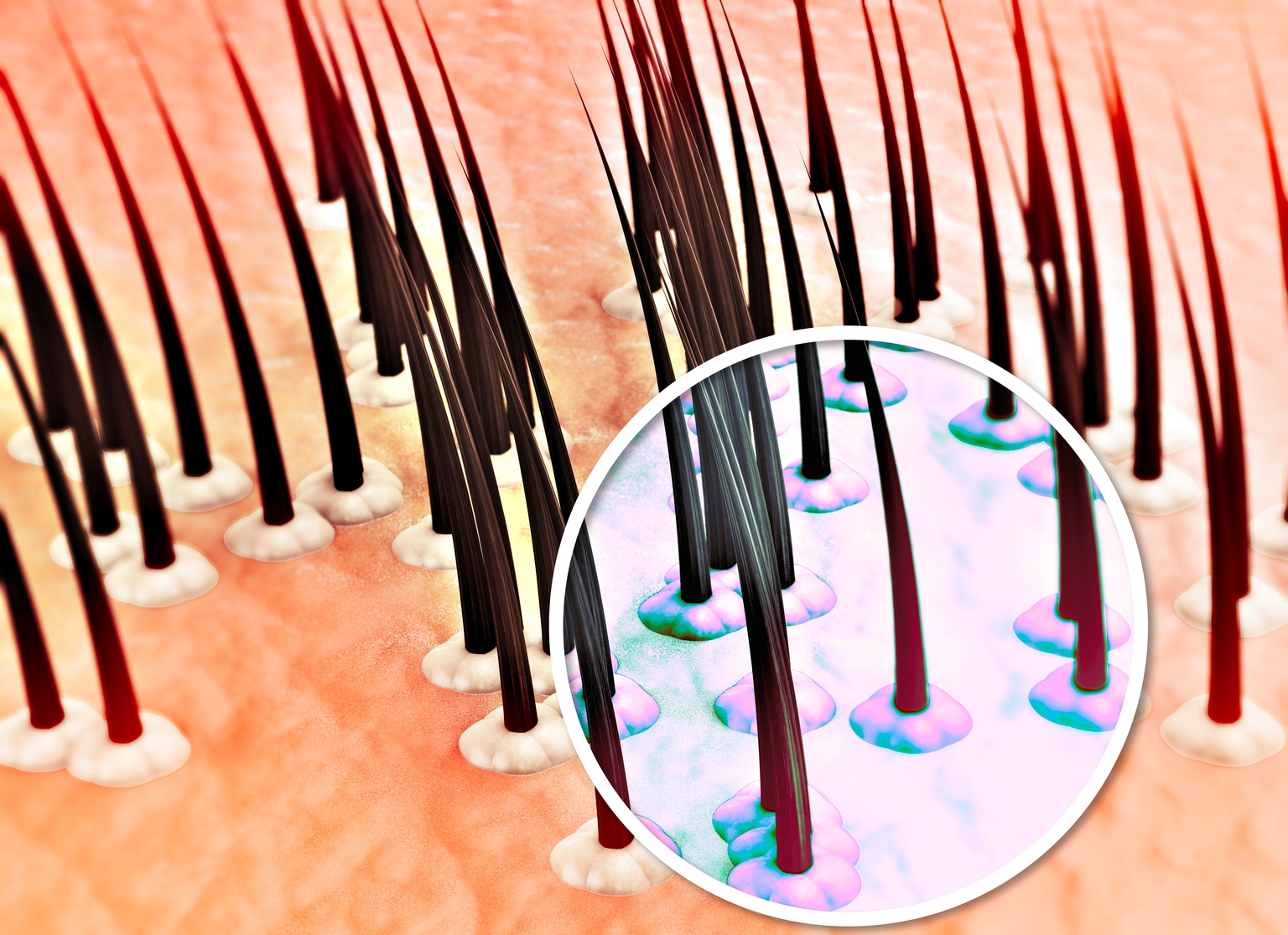 Kintor Shares Plunge After Hair-Loss Drug Flops In Clinical Trials ...