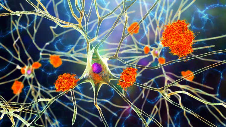 Biogen, Eisai Alzheimer's candidate lecanemab meets primary endpoint in ... Biogen, Eisai Alzheimer's candidate lecanemab meets primary endpoint in ...