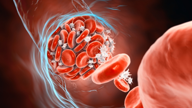 GOSS stock drops even as PAH candidate reaches main goal in Phase 2 ...