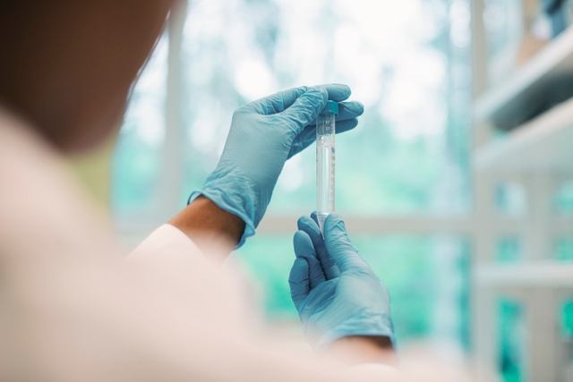 Alvotech gains on FDA acceptance of Entyvio biosimilar BLA (ALVO:NASDAQ ...