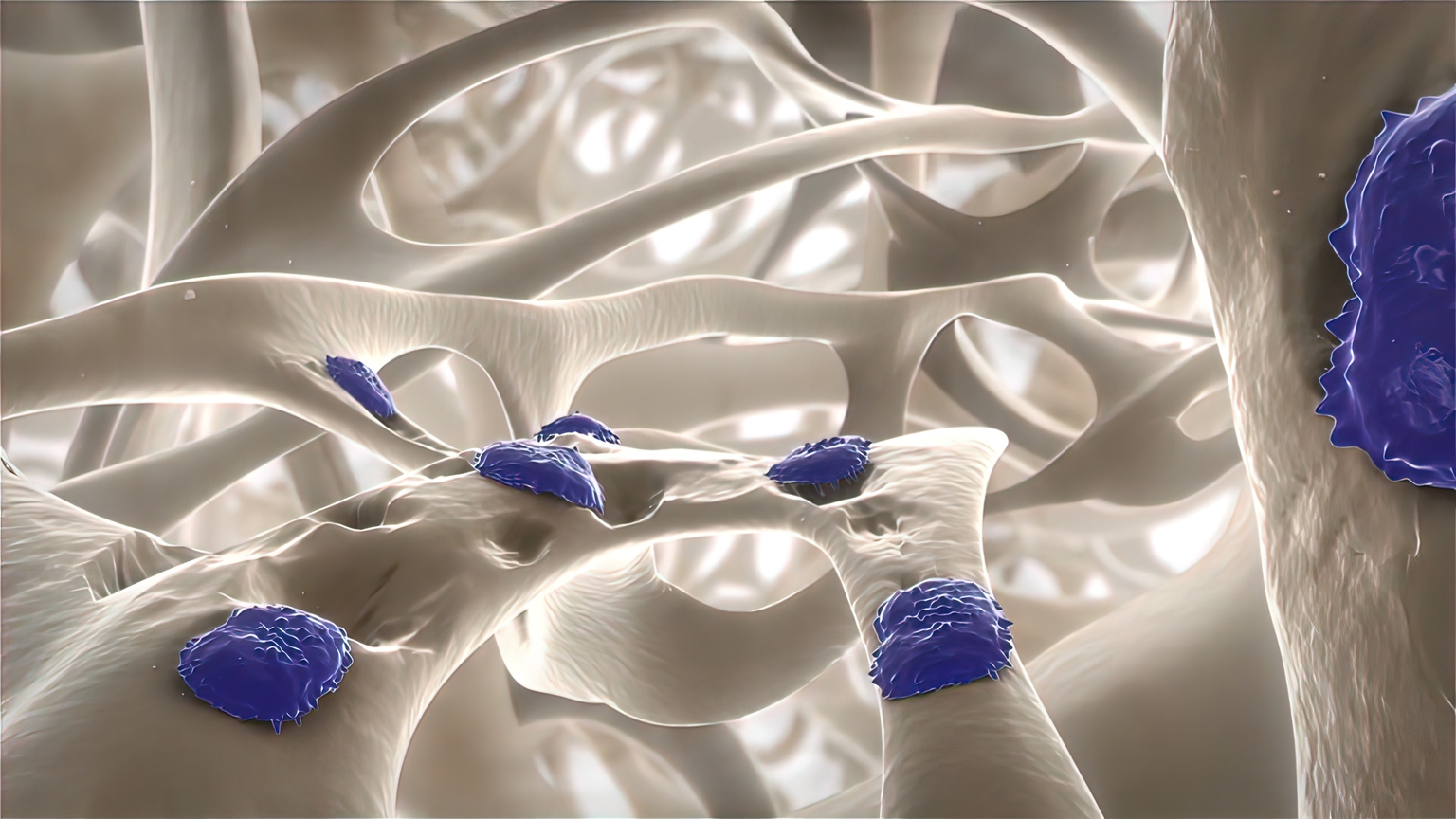 Ultragenyx: Rating Speculative Buy, Playing Setrusumab Data Release ...