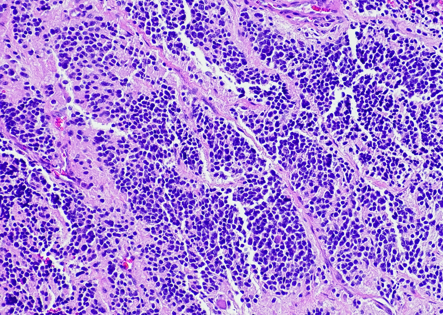 Y-mAbs down 19% on FDA briefing docs on omburtamab, but BofA still ...