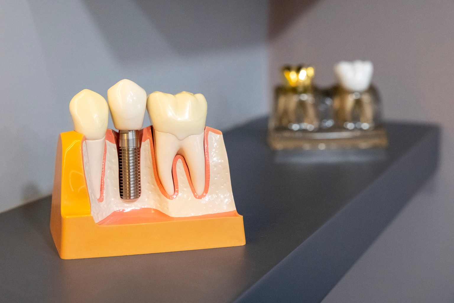 Straumann Holding: A Global Leader, But Too Expensive For Me (OTCMKTS ...