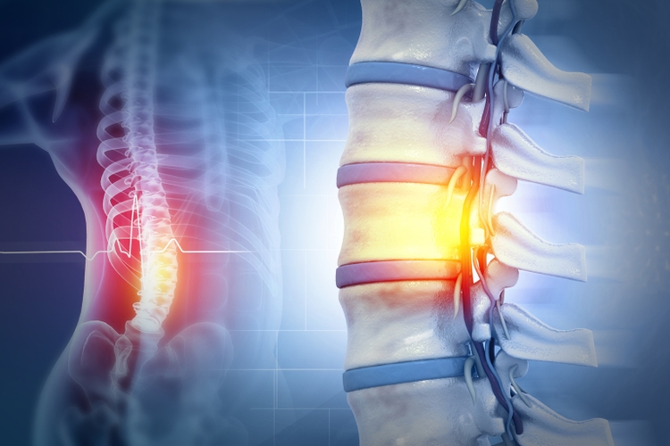NervGen: Data For Treatment Candidate For Spinal Cord Injury Probably ...