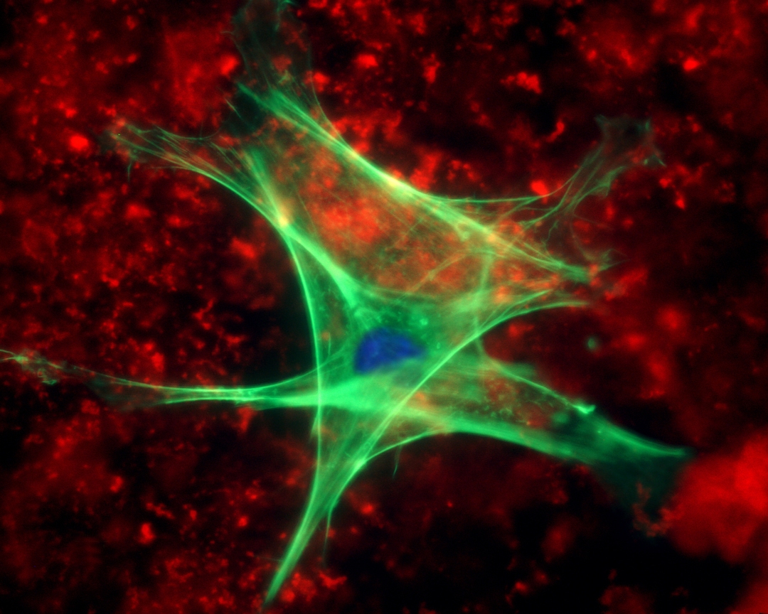 Cytek Stock: Undisputed Next-Gen Flow Cytometry Leader (NASDAQ:CTKB ...