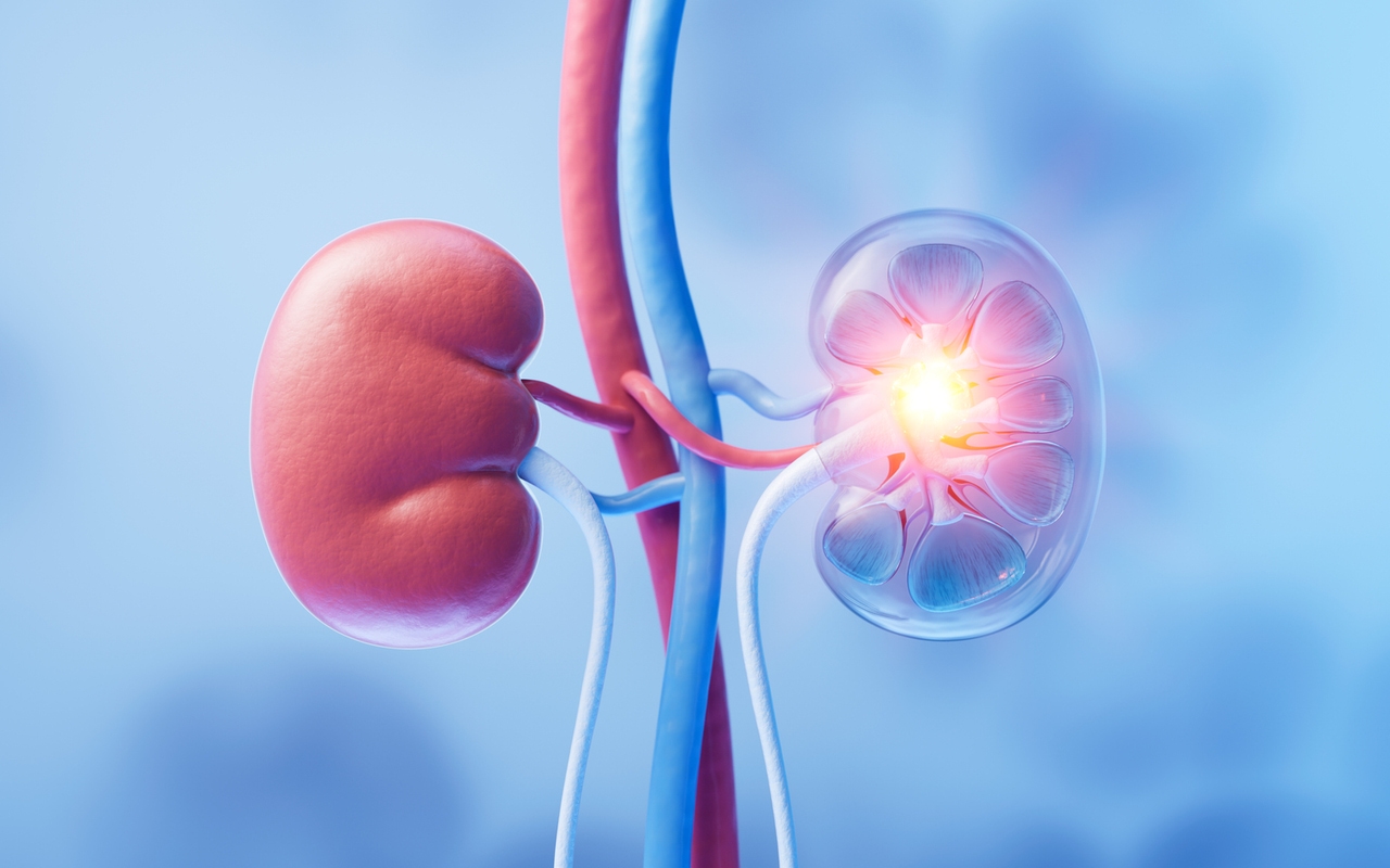2025 Will Be A Major Year For ProKidney’s Rilparencel In CKD Treatment ...