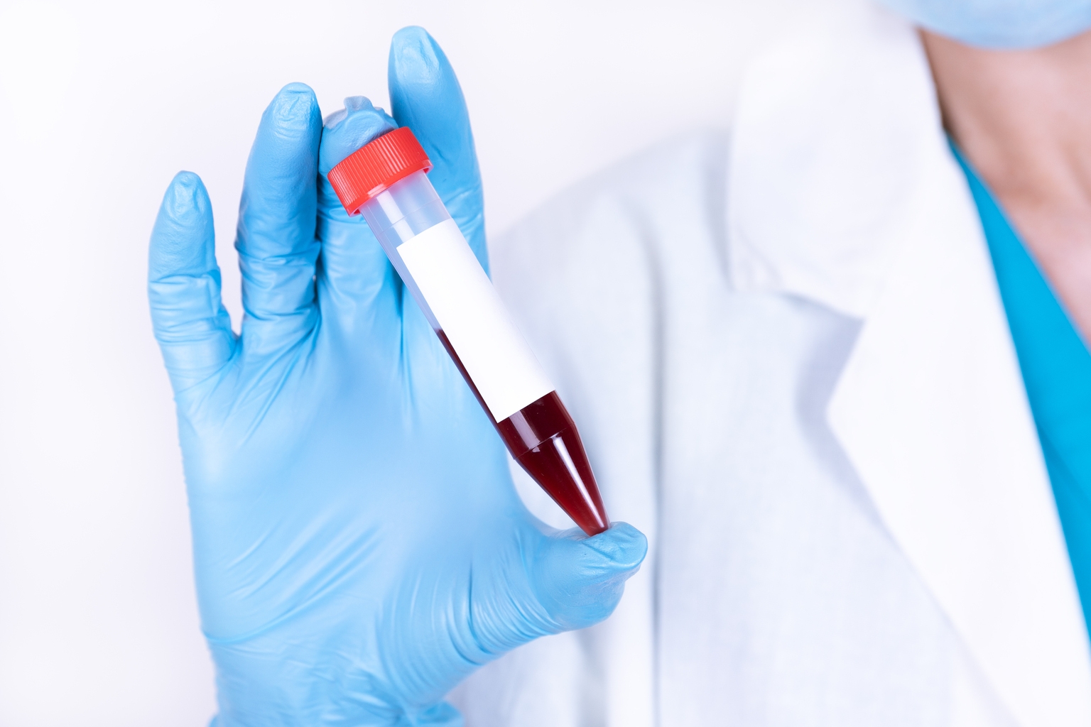 Sana Biotechnology: SC291 Moving Forward Beyond Hematological ...