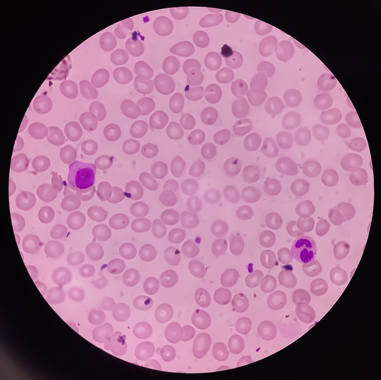 Geron Stock: Innovative Rytelo Enters A Challenging MDS Market (NASDAQ ...