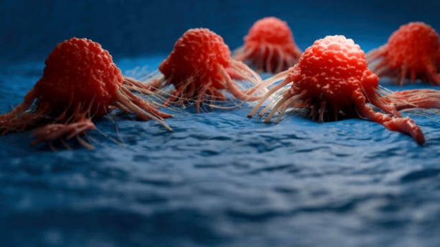 UroGen stock in focus after IconOVir deal (URGN:NASDAQ) | Seeking Alpha