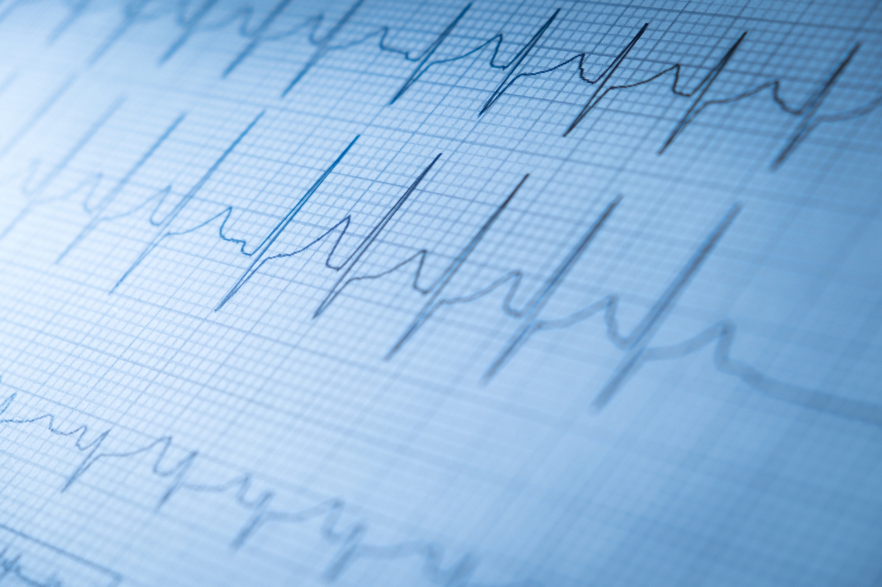CeriBell: An Interesting EEG Play Going Public (NASDAQ:CBLL) | Seeking ...