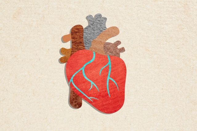 Edgewise posts trial data for heart disease drug (EWTX:NASDAQ ...