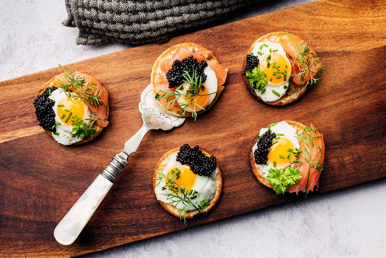 Chefs’ Warehouse: Luxury Dining Meets Resilient Growth (NASDAQ:CHEF ...