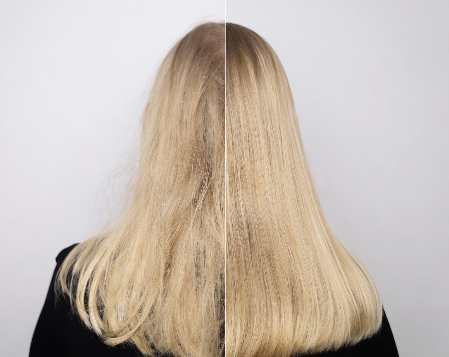 The Bottom Fishing Club - Olaplex: Solid Turnaround Potential In Hair ...