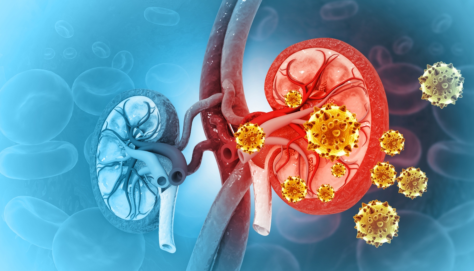 Vera Therapeutics: Stock Rises As IgAN Approval Chances Increase - I'm On Sidelines (VERA ...