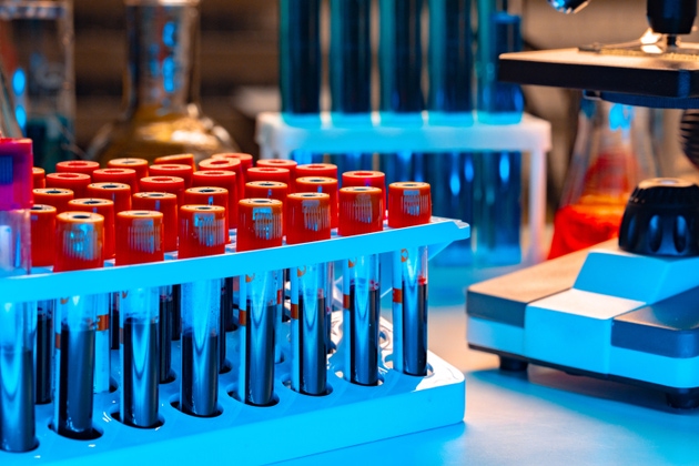 Zenas: 'Strong Buy' On Obexelimab Enhancement And Expected SLE Data Q4 ...