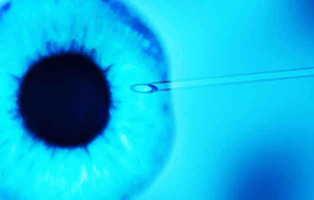 Why Sanofi May Need To Top $2.4 Billion For Ocular Therapeutix (NASDAQ ...