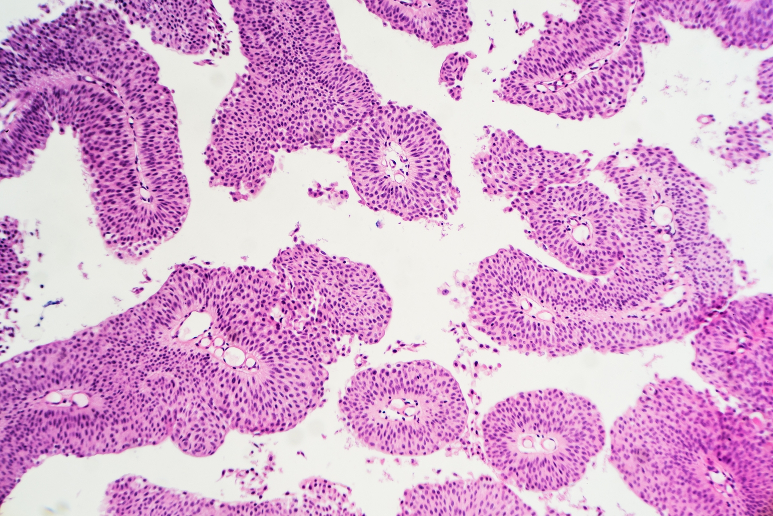 Aktis Oncology: Mini-Proteins With A Targeted Punch (NASDAQ:AKTS ...
