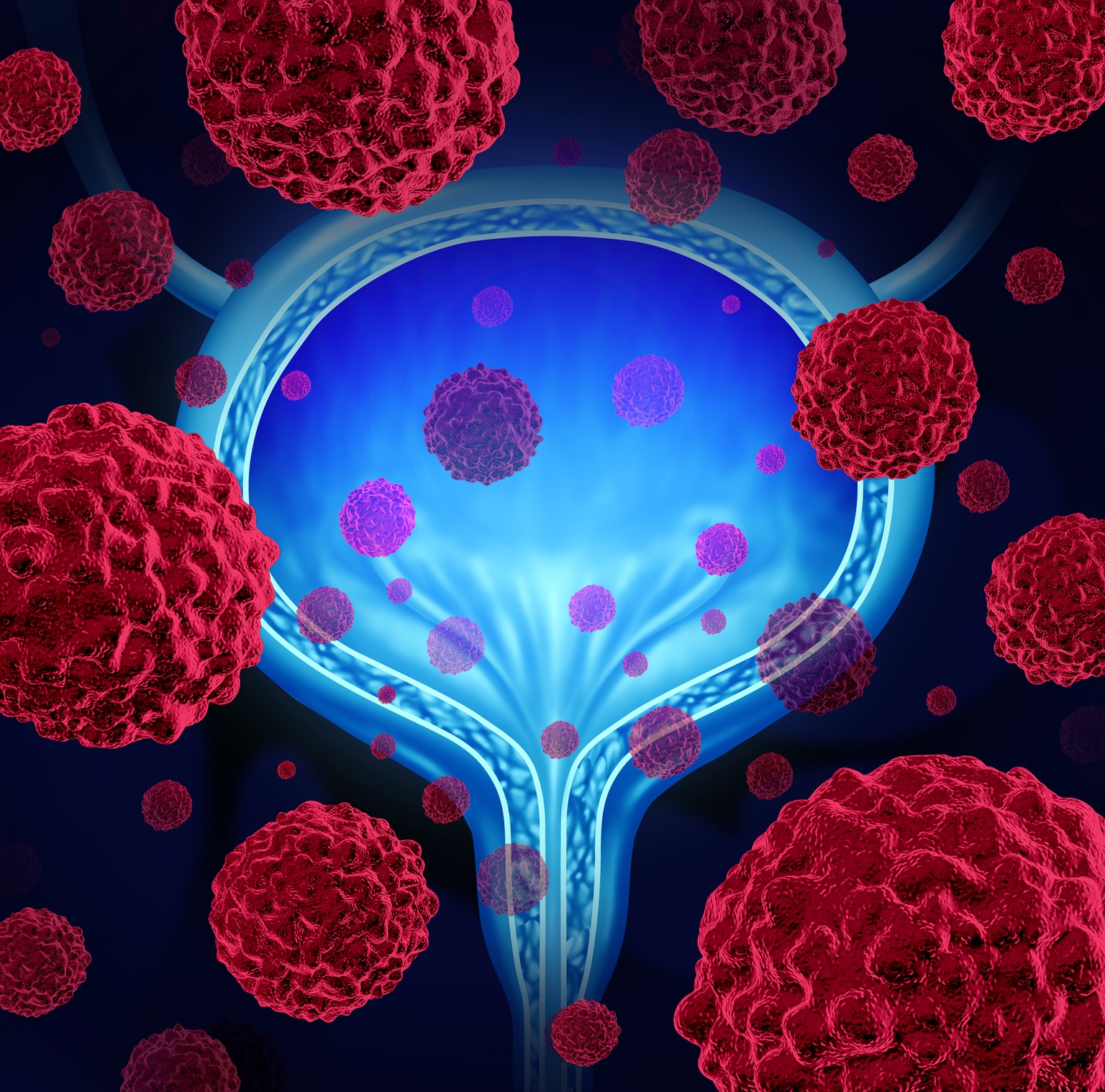 ImmunityBio wins EU nod for bladder cancer dug (IBRX:NASDAQ) | Seeking ...