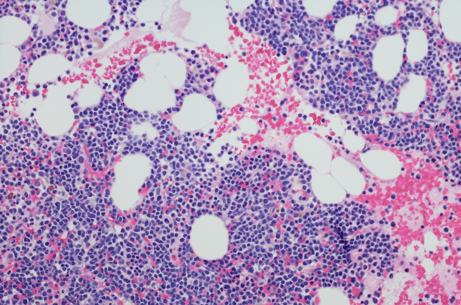 Assessing BioLineRx As A Buy After Drug Approval (NASDAQ:BLRX ...