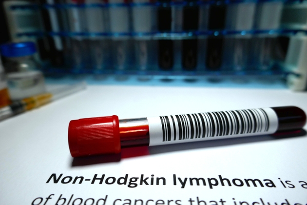 Legend Bio posts early-stage data for CAR-T drug (LGND:NASDAQ ...