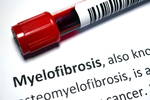 Galecto stock rallies 25% on positive data for myelofibrosis drug (GLTO ...