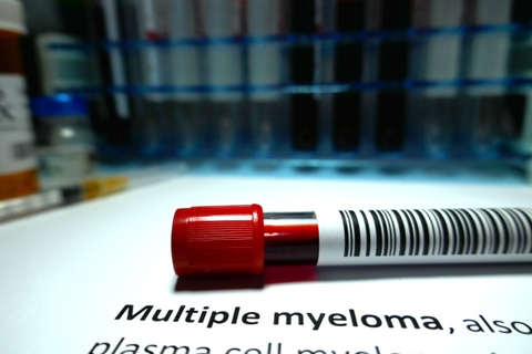 J&J multiple myeloma drug Talvey cuts mortality risk (JNJ:NYSE ...