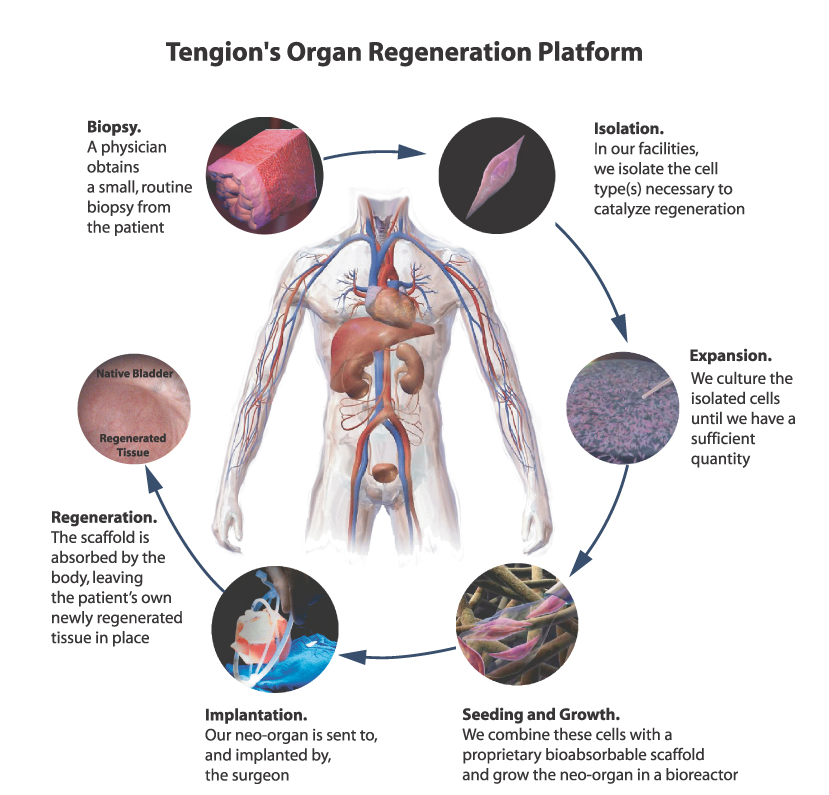 Tengion: A Cautionary Tale For Regenerative Medicine Bulls (OTCMKTS ...