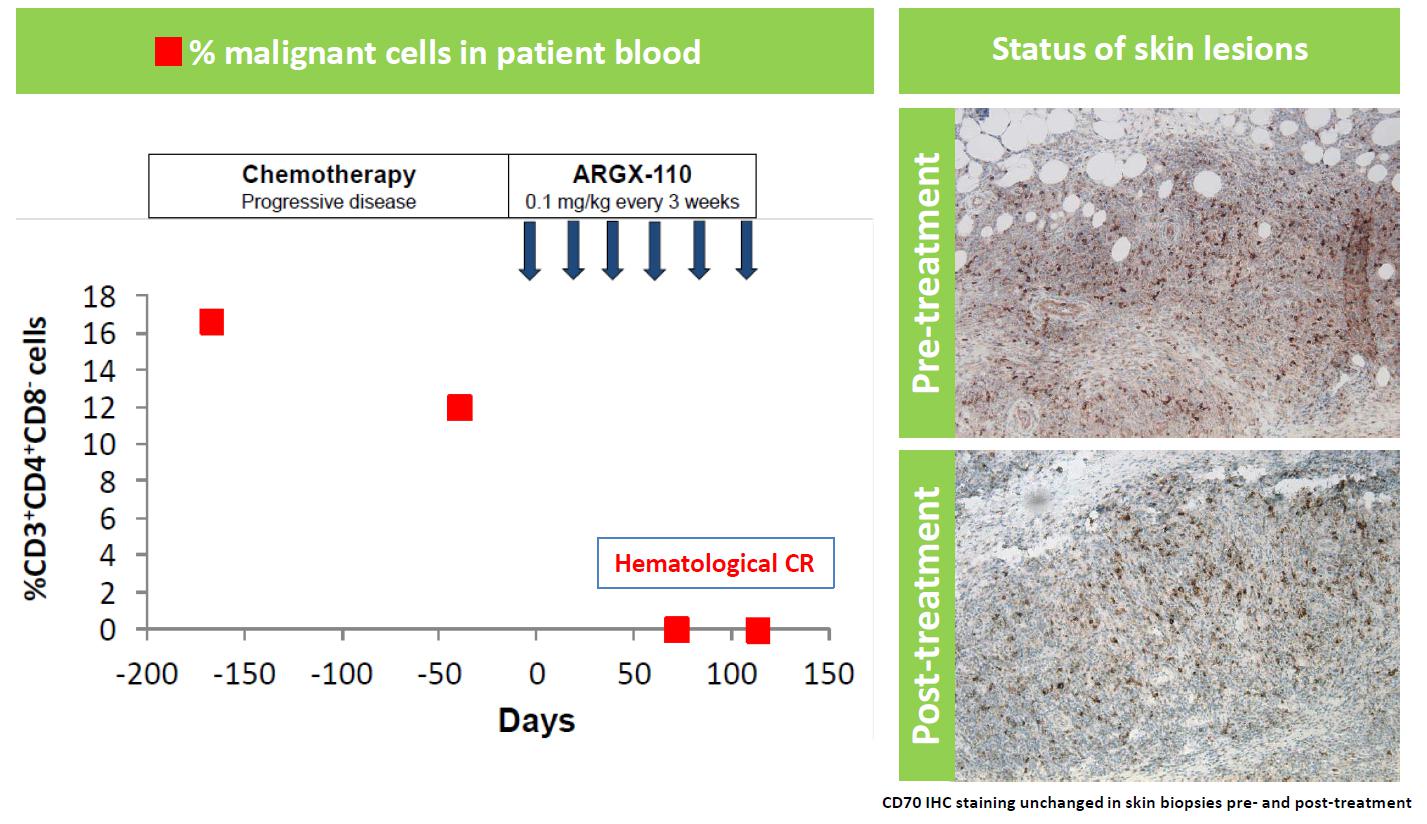 ArGEN-X: Forging The Future Of Antibodies (OTCMKTS:ARGNF) | Seeking Alpha