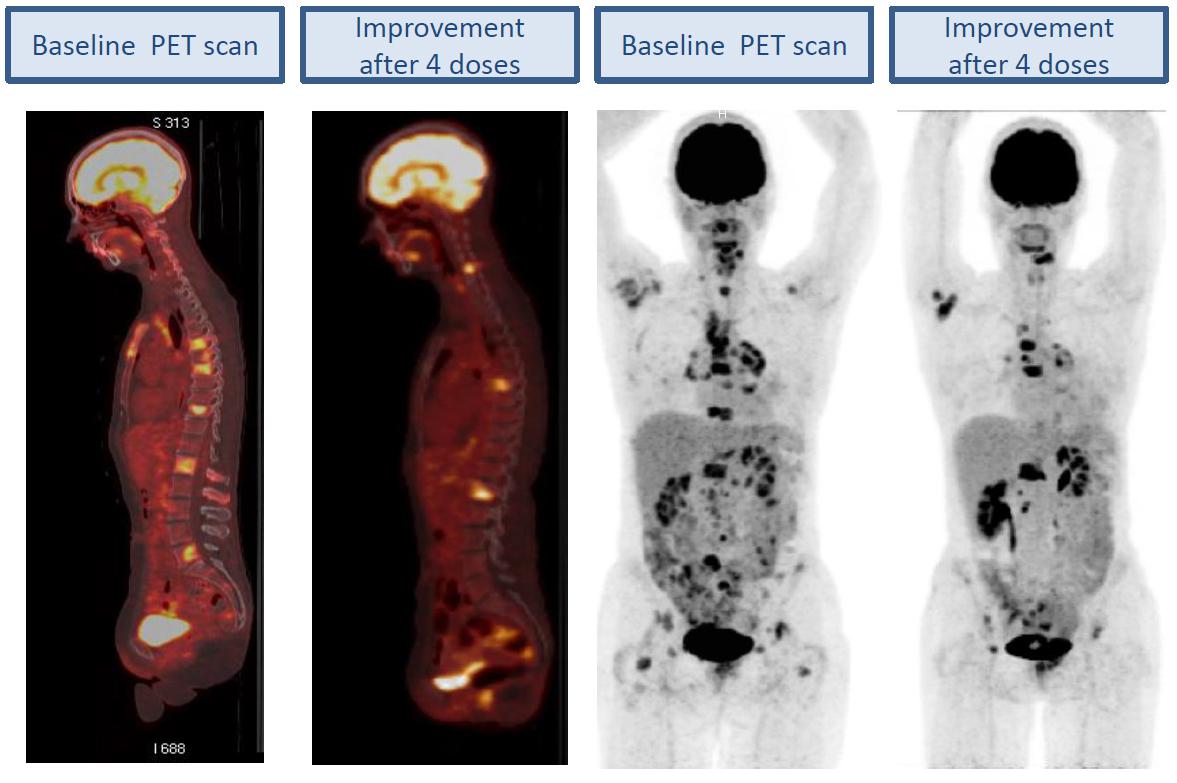 ArGEN-X: Forging The Future Of Antibodies (OTCMKTS:ARGNF) | Seeking Alpha