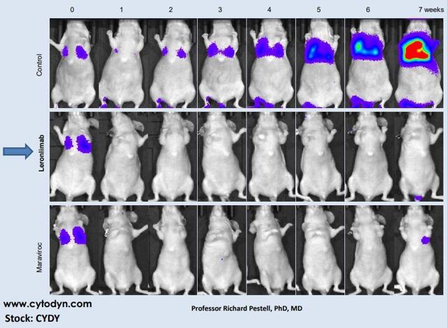 CytoDyn: Passing PRO-140 Milestones While Generating More (OTCMKTS:CYDY ...