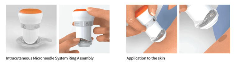 Zosano Pharma: Early PK+Safety Study In Q3 May Breathe New Life Into ...