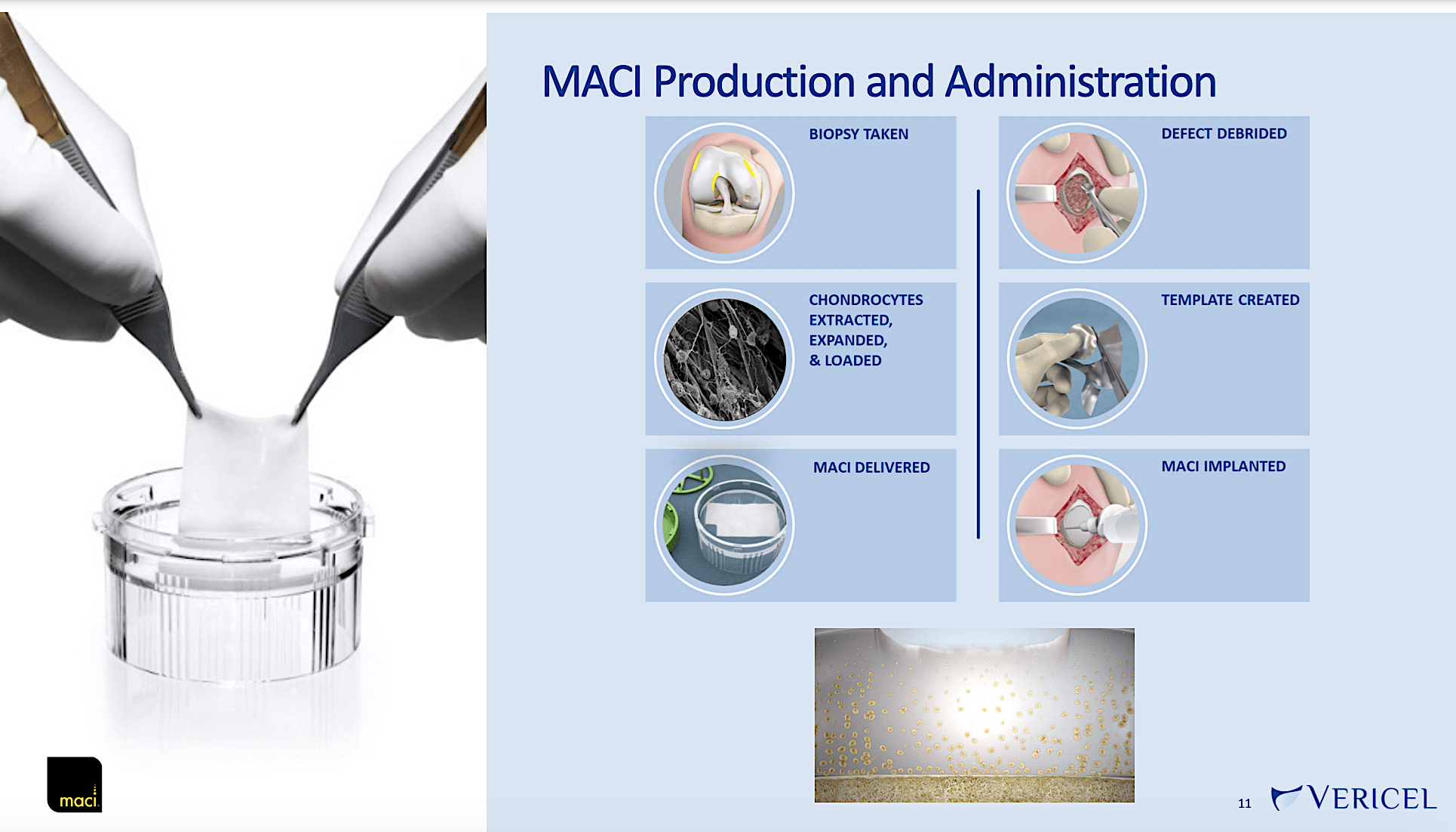 Vericel Stock (VCEL): A Leader In Cell-Based Therapy | Seeking Alpha