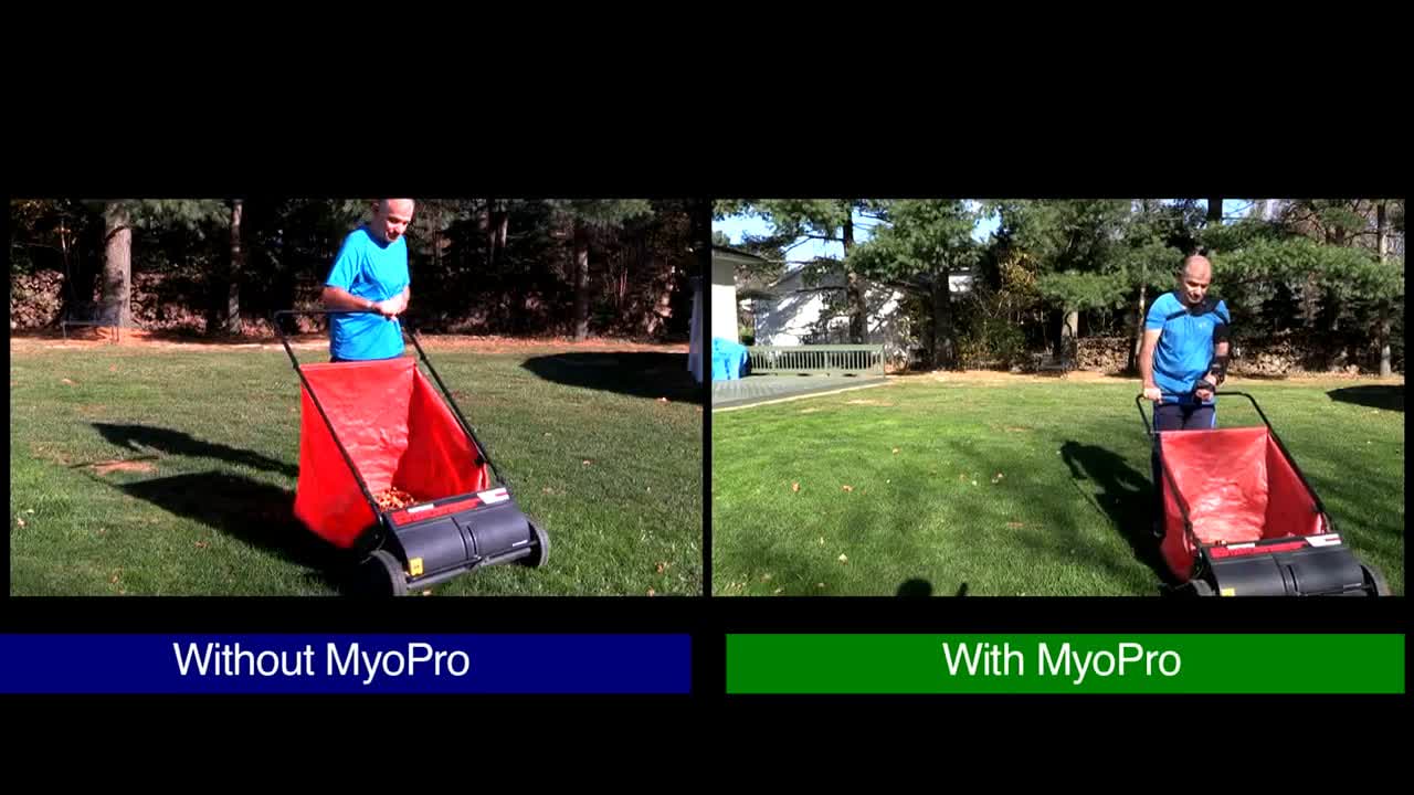 Myomo: Ridiculously Cheap Medtech (NYSE:MYO) | Seeking Alpha