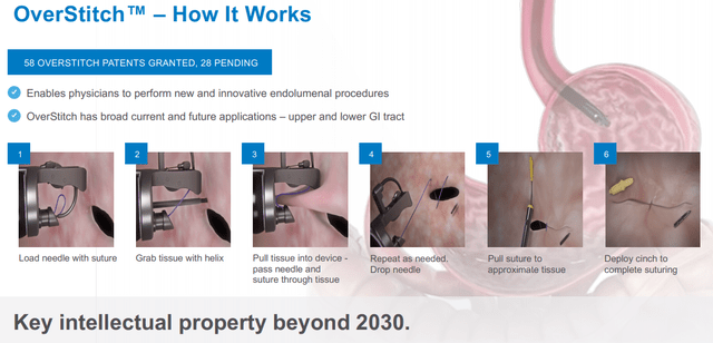 Apollo Endosurgery: New Management Bounce Makes This Stock A Buy ...
