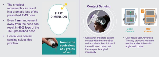 Neuronetics Q1 Earnings: Profit Potential Remains Uncertain (NASDAQ ...