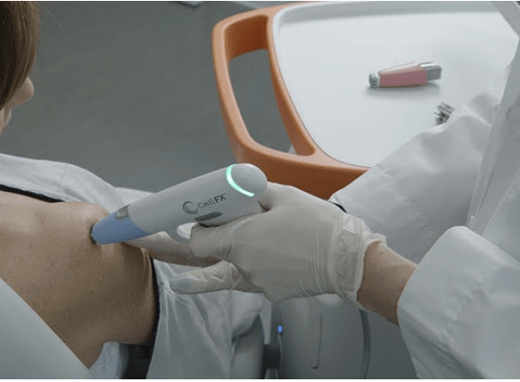 Pulse Biosciences: Building Momentum Around Nano-Pulse Segment (NASDAQ ...