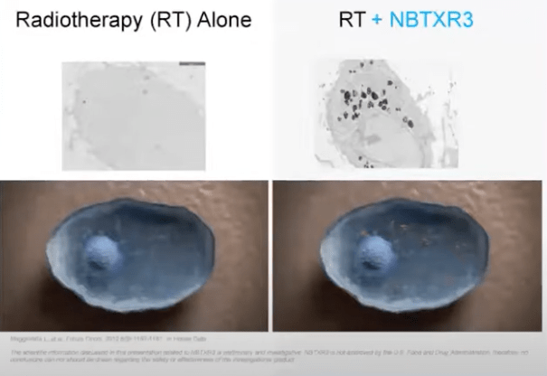 Nanobiotix: A Promising Cancer Treatment But A Risky Investment For Now ...