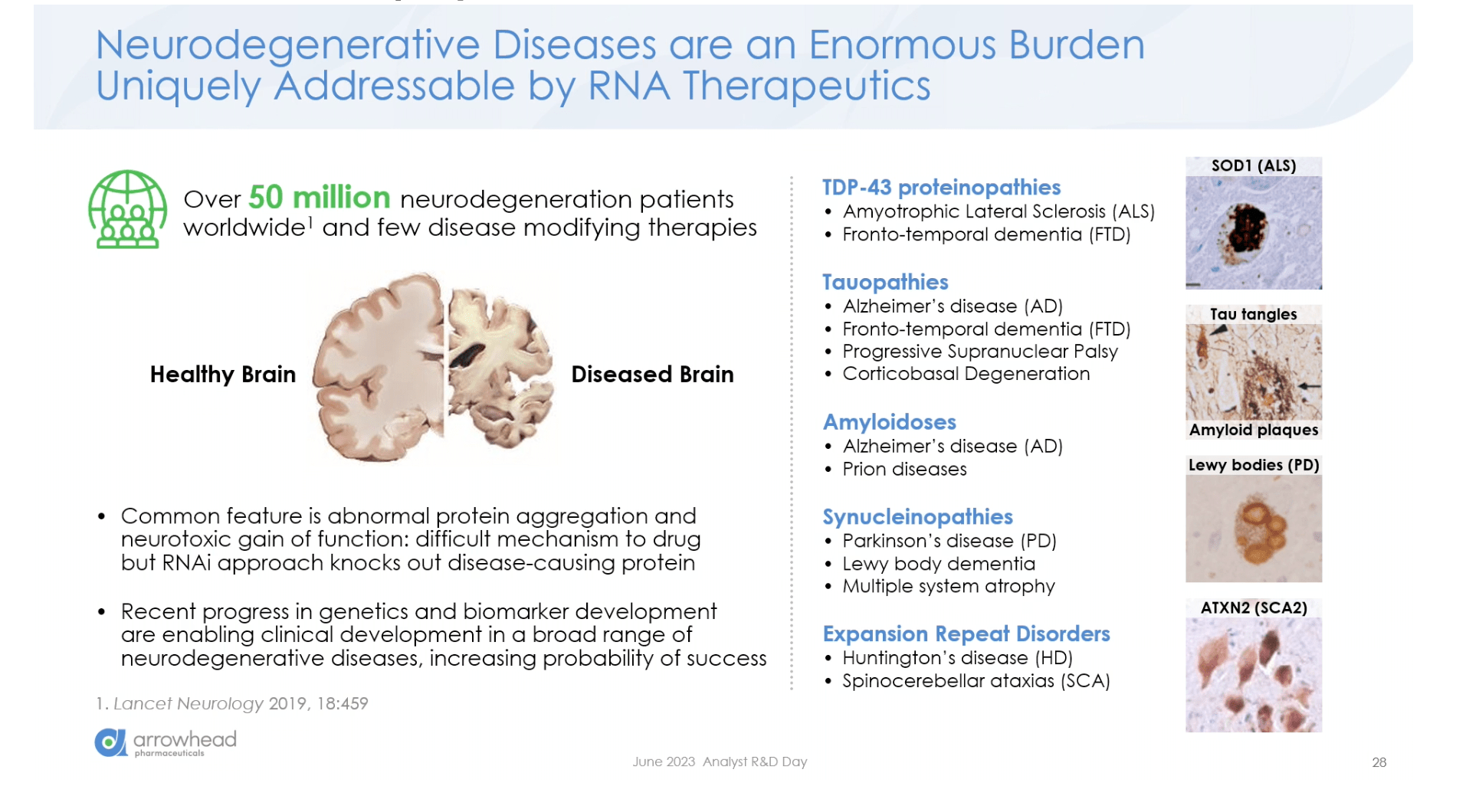 Arrowhead Stock: Biotech Innovation On Display (NASDAQ:ARWR) | Seeking ...
