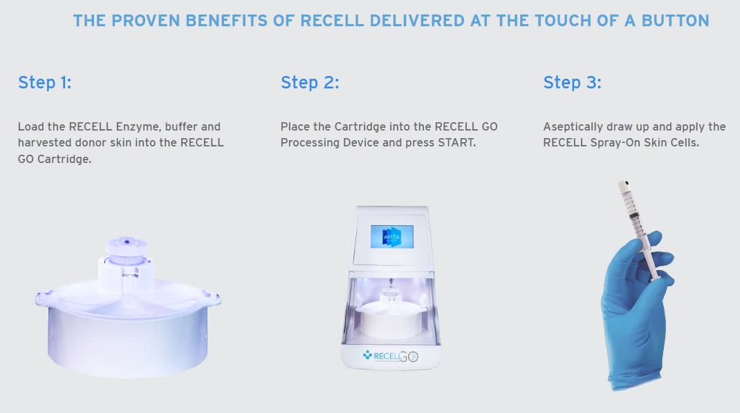 AVITA Medical Headed For Its Most Important Report, I’m Bullish (NASDAQ ...