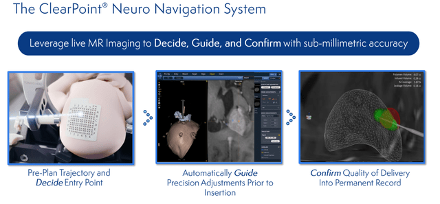 ClearPoint Neuro: Investors Enamored With Its Growth Prospects (NASDAQ ...