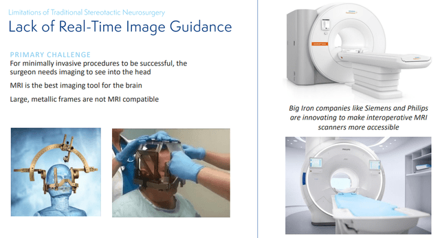 ClearPoint Neuro Stock: Potential Inflection Point (NASDAQ:CLPT ...