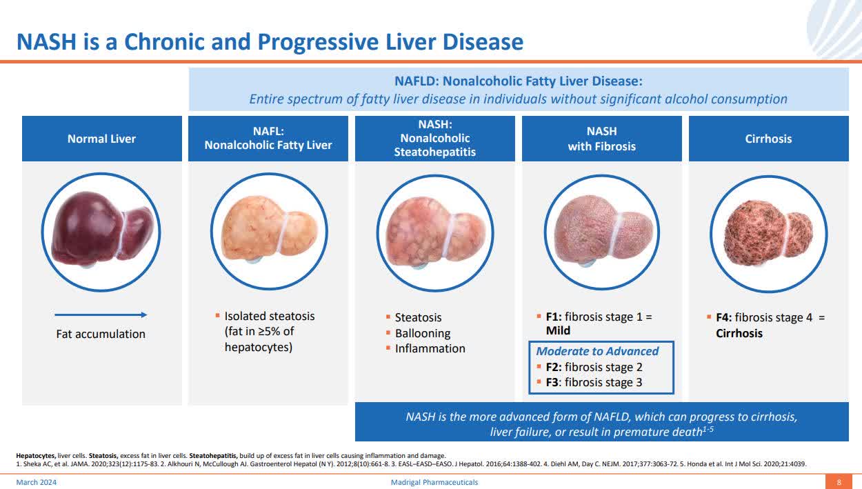 Madrigal: Accelerated Rezdiffra Approval Puts It In The NASH Lead ...
