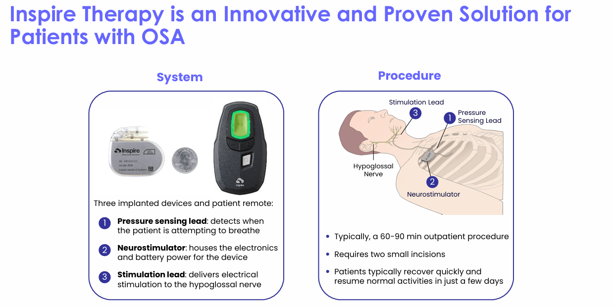 Inspire Medical Systems: A Post Q1 Assessment (NYSE:INSP) | Seeking Alpha